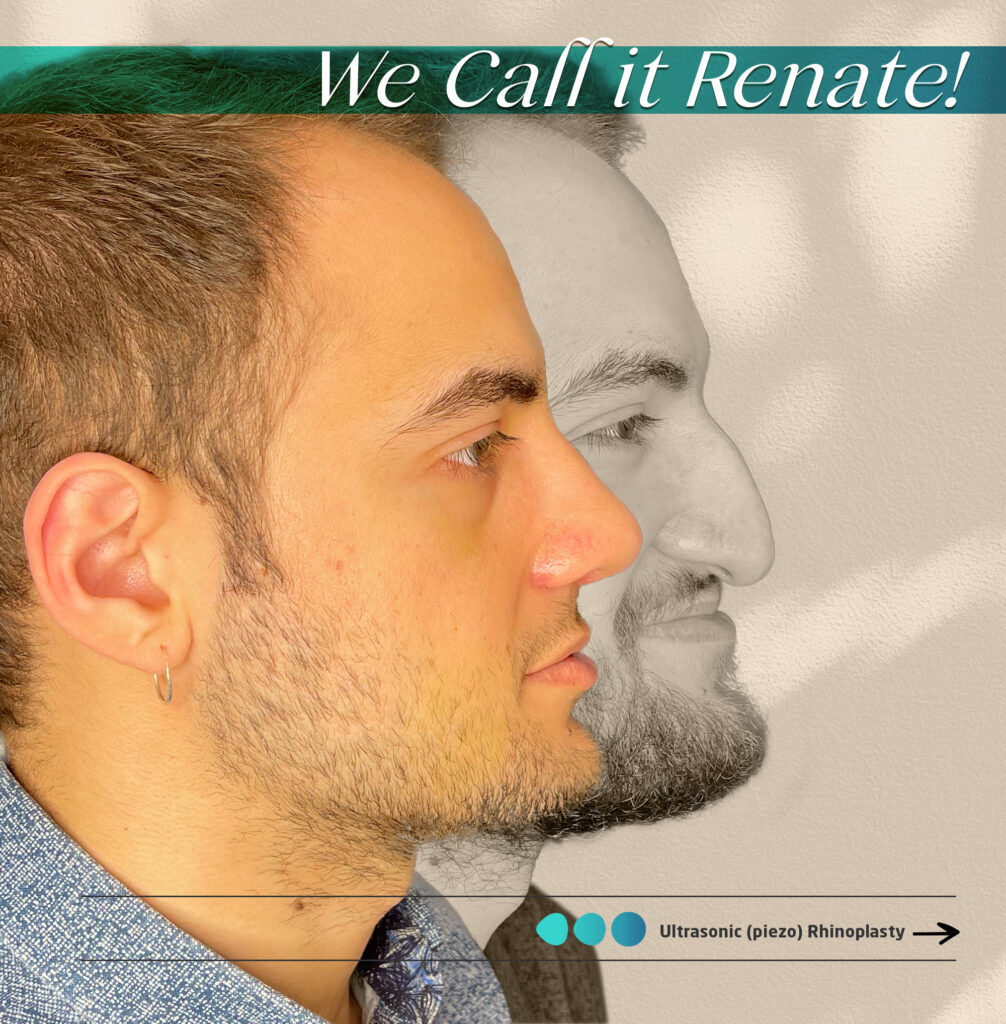 BEFORE/AFTER - Renate Clinic