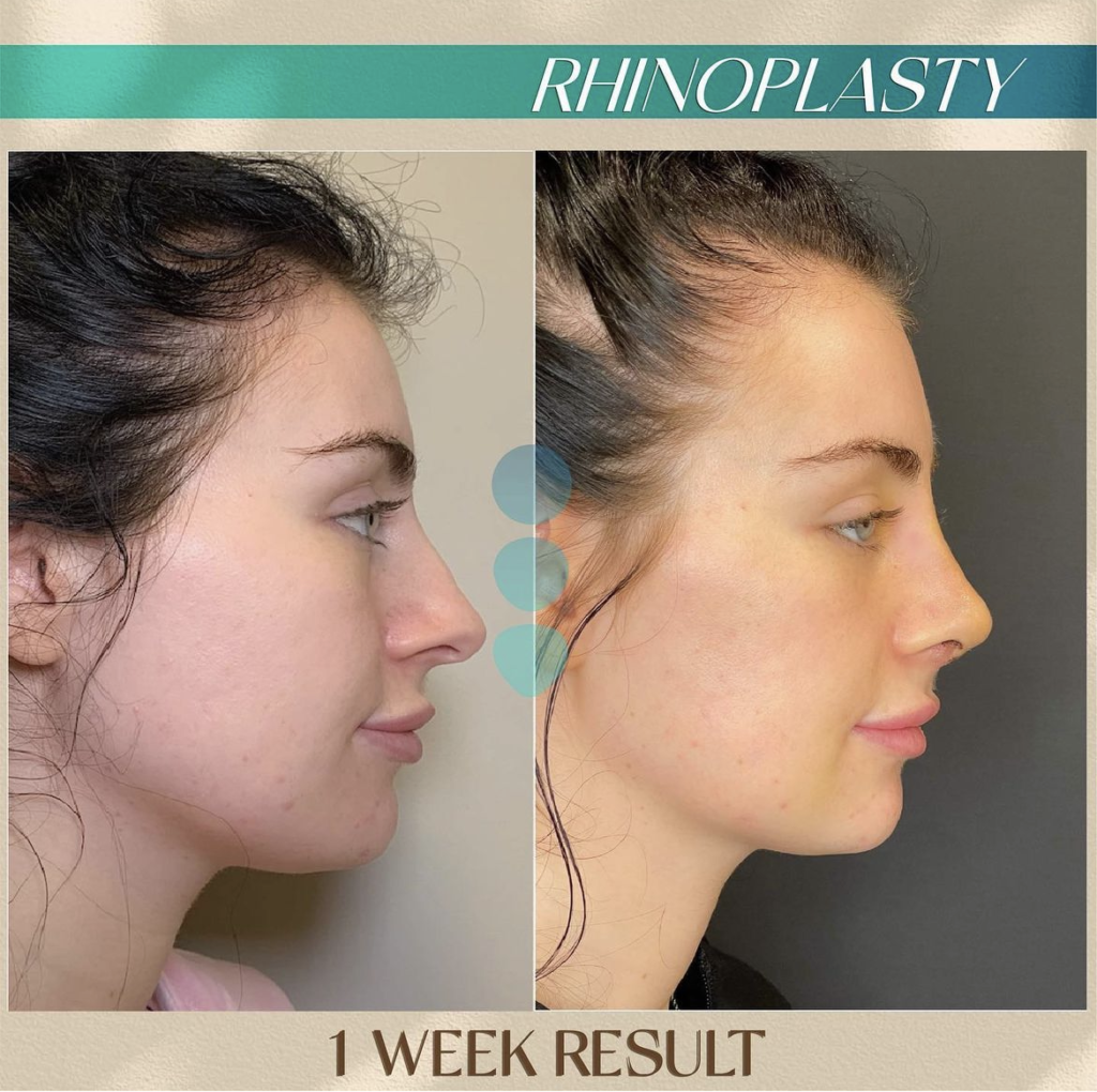 BEFORE/AFTER - Renate Clinic
